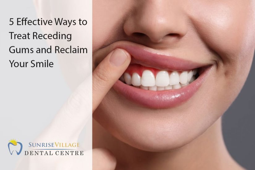 5 Effective Ways to Treat Receding Gums and Reclaim Your Smile ...